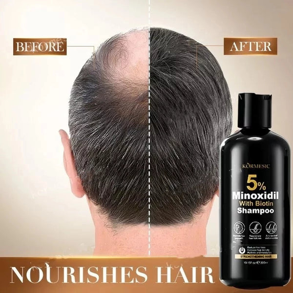 KORMESIC 5% Minoxidil with Biotin Shampoo 300ml | Strengthens ...