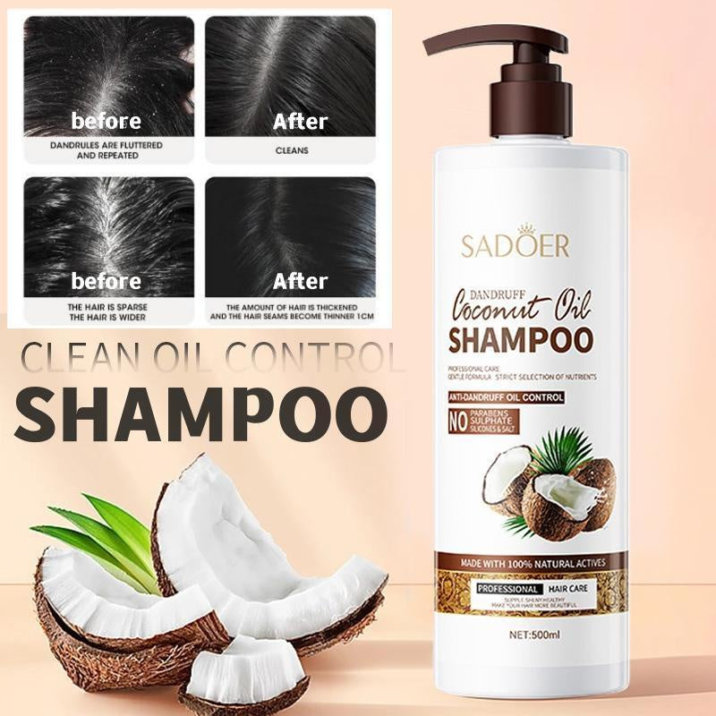 SADOER Coconut Oil Moisturizing Hair Care Dandruff Shampoo – Beauty Vault Ph